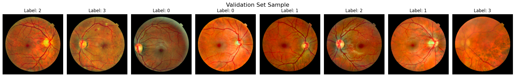 Retina classification using Convolutional Neural Networks — RISE_Tutorials