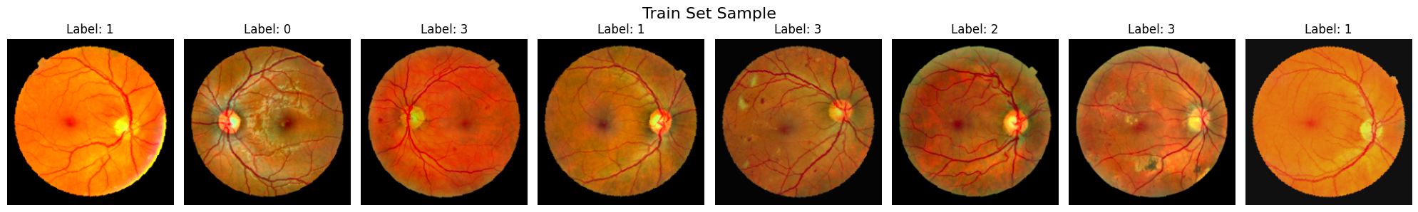 Retina classification using Convolutional Neural Networks — RISE_Tutorials