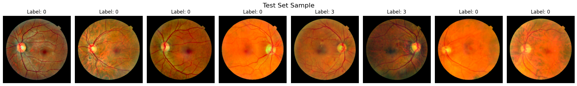 Retina classification using Convolutional Neural Networks — RISE_Tutorials