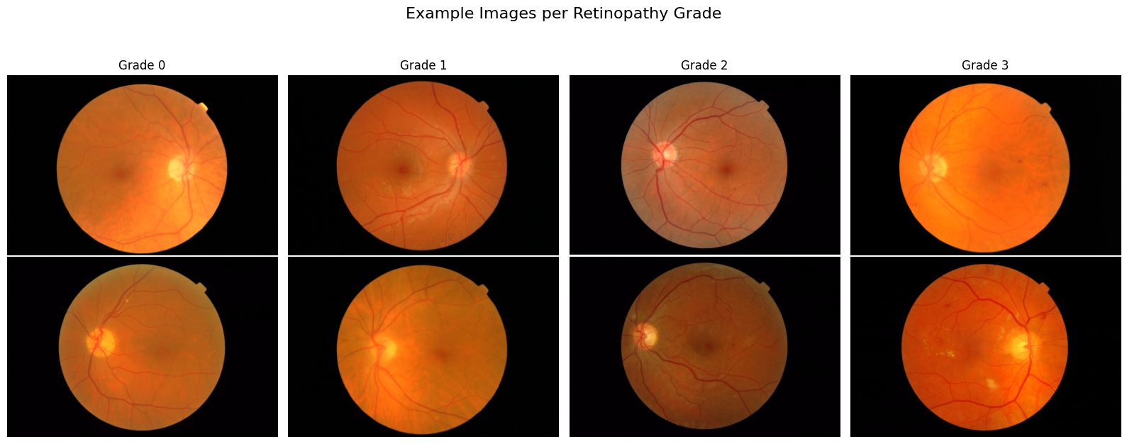 Retina classification using Convolutional Neural Networks — RISE_Tutorials