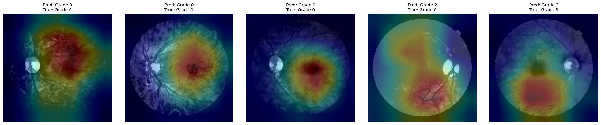 Retina classification using Convolutional Neural Networks — RISE_Tutorials
